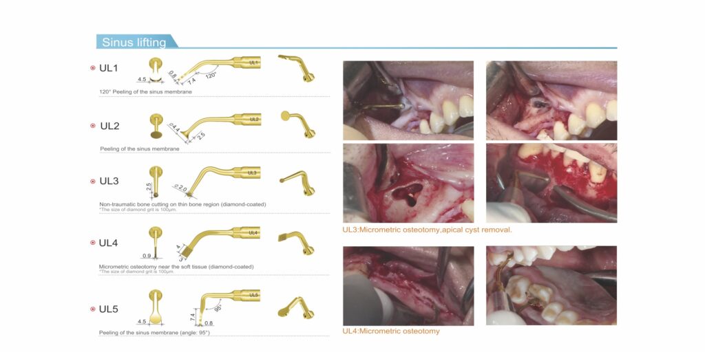 Piezo surgery | Paytekht Company